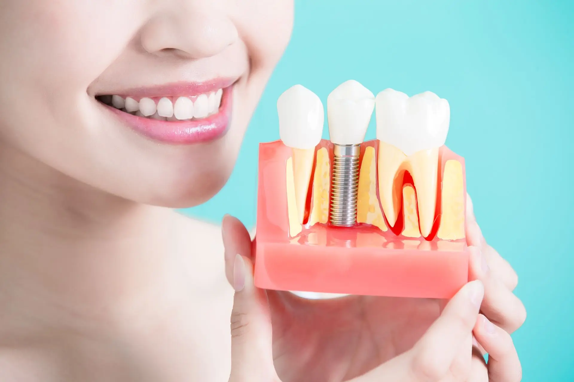 How Periodontics And Implant Dentistry Work Together For Lifelong ...