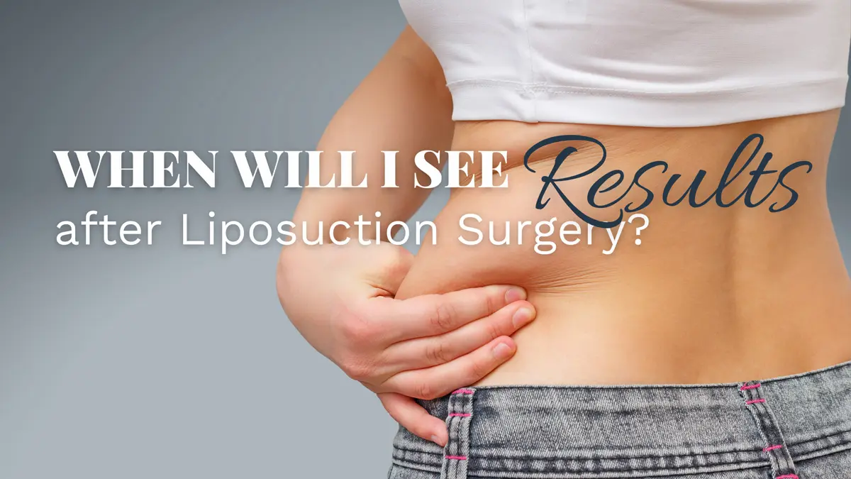 Liposuction Results: When Will I See My Results and What to Expect ...