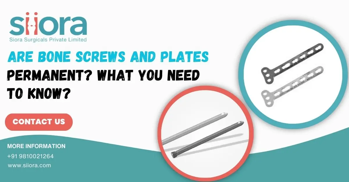 Are Bone Screws and Plates Permanent? What You Need to Know? | bigwritehook
